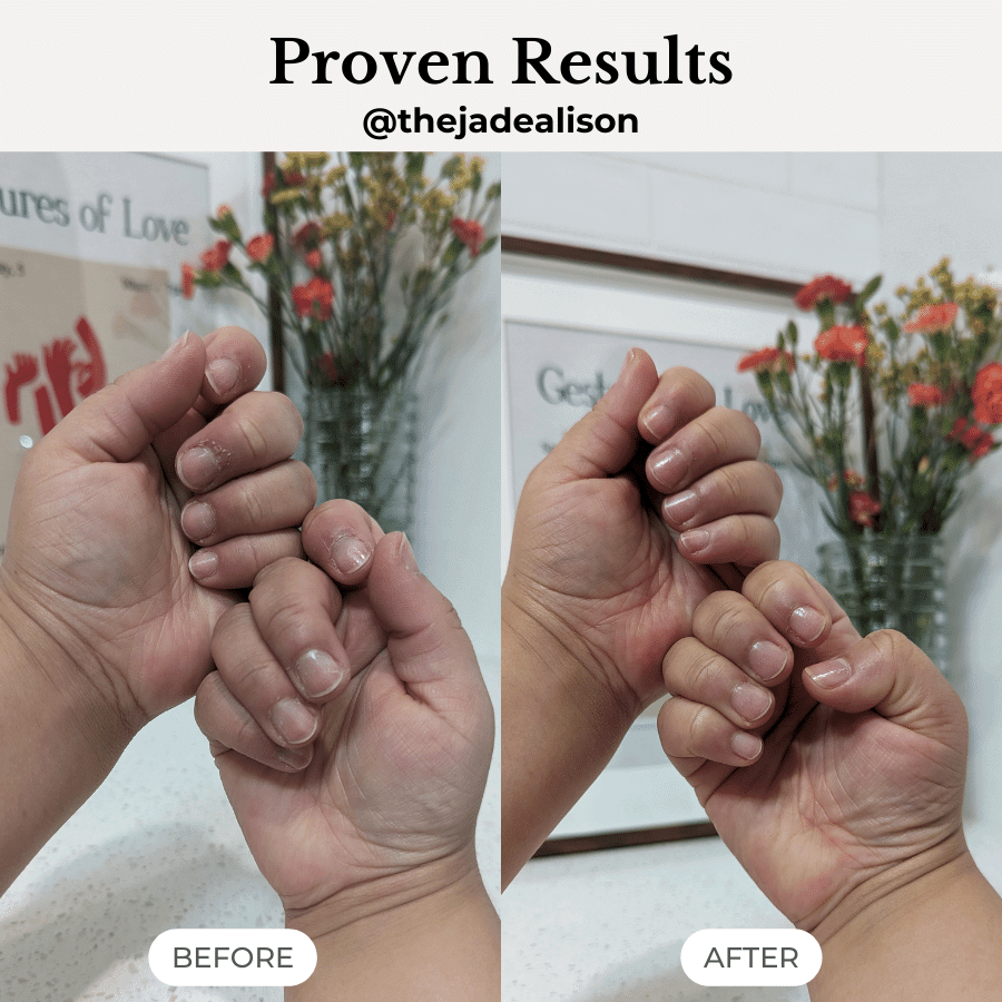 Hand & Skin Shield Intensive Repair – Natralus Australia